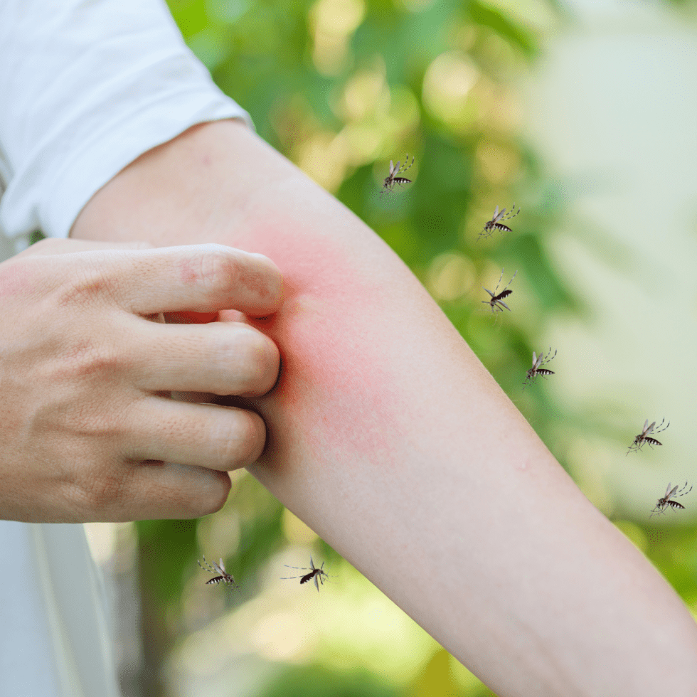 Mosquitoes: Tips and Tricks for Best Mosquito Control for Yards